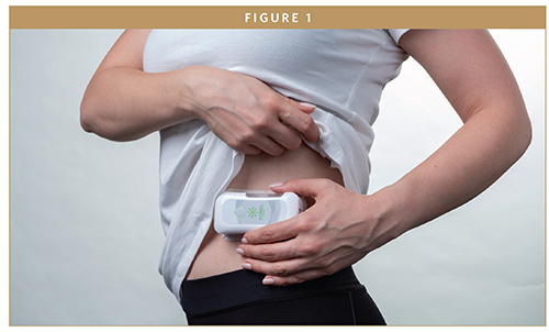 WEARABLE PLATFORM - Next-Generation Wearable Drug Delivery: Prefilled ...