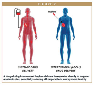 DRUG-ELUTING IMPLANTS - Sustained-Release Implants - A Targeted ...