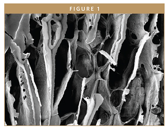 ORALLY DISINTEGRATING TABLETS - Patient-Centric Dose Design ...
