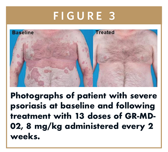 GALECTIN-DIRECTED THERAPIES - Targeting Galectin-3 Protein in Drug Development